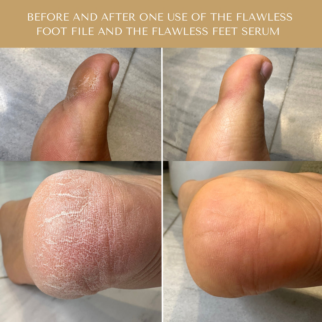 Serum Doctor - Flawless Feet